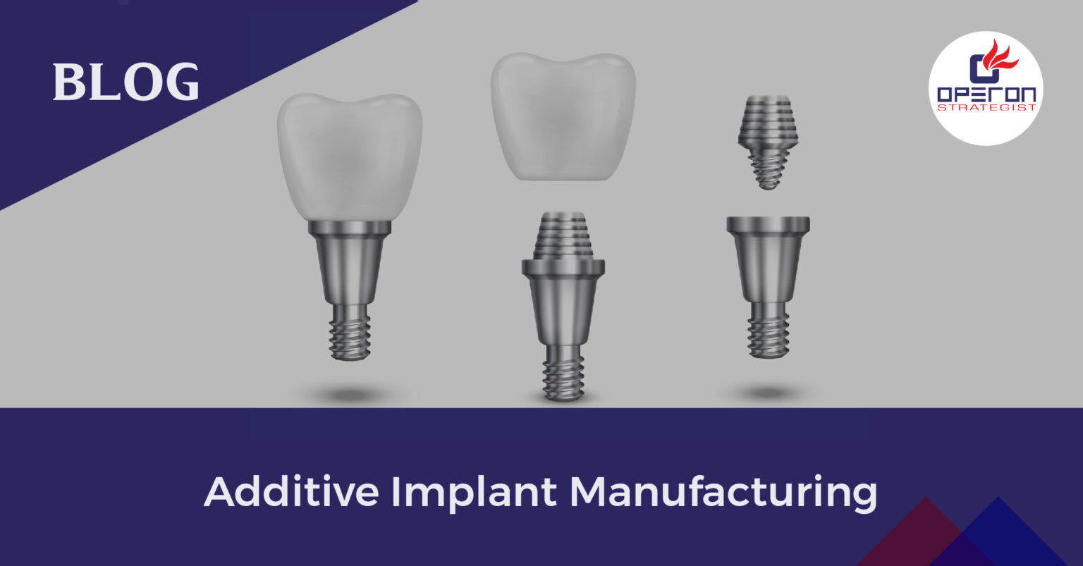 Additive implant manufacturing (Complete Guide) | Operon Strategist