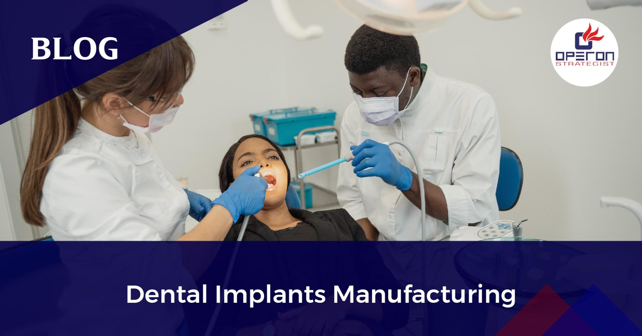 Dental Implants Manufacturing | Complete Guide by Operon Strategist