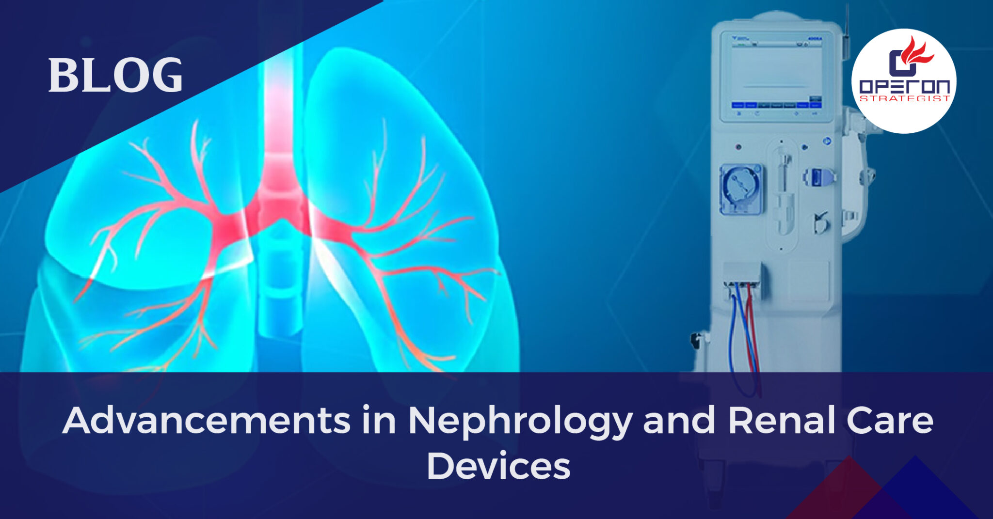 Nephrology and Renal Care Devices : Quick Guide | Operon Strategist